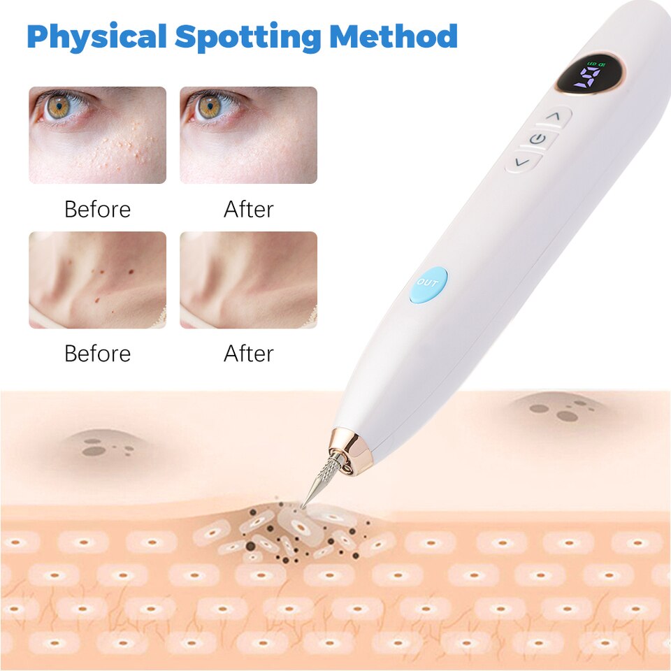 9 Mode Plasma Pen Freckle Remove Pen - Adonistrade