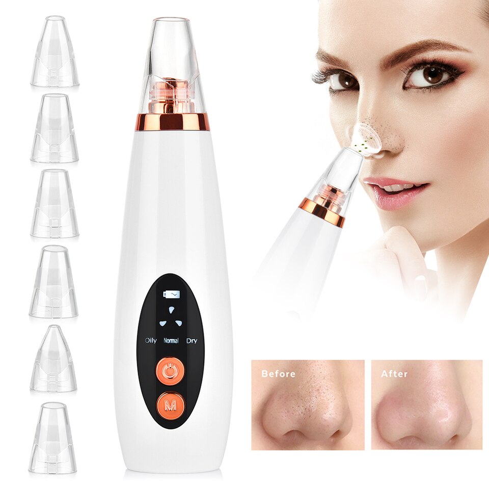 Extractor Vacuum Pore Nose Cleaner Eliminators Beauty Tool - Adonistrade